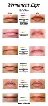 Permanent Makeup Before And After Lips Before & After Naomi O'Hara